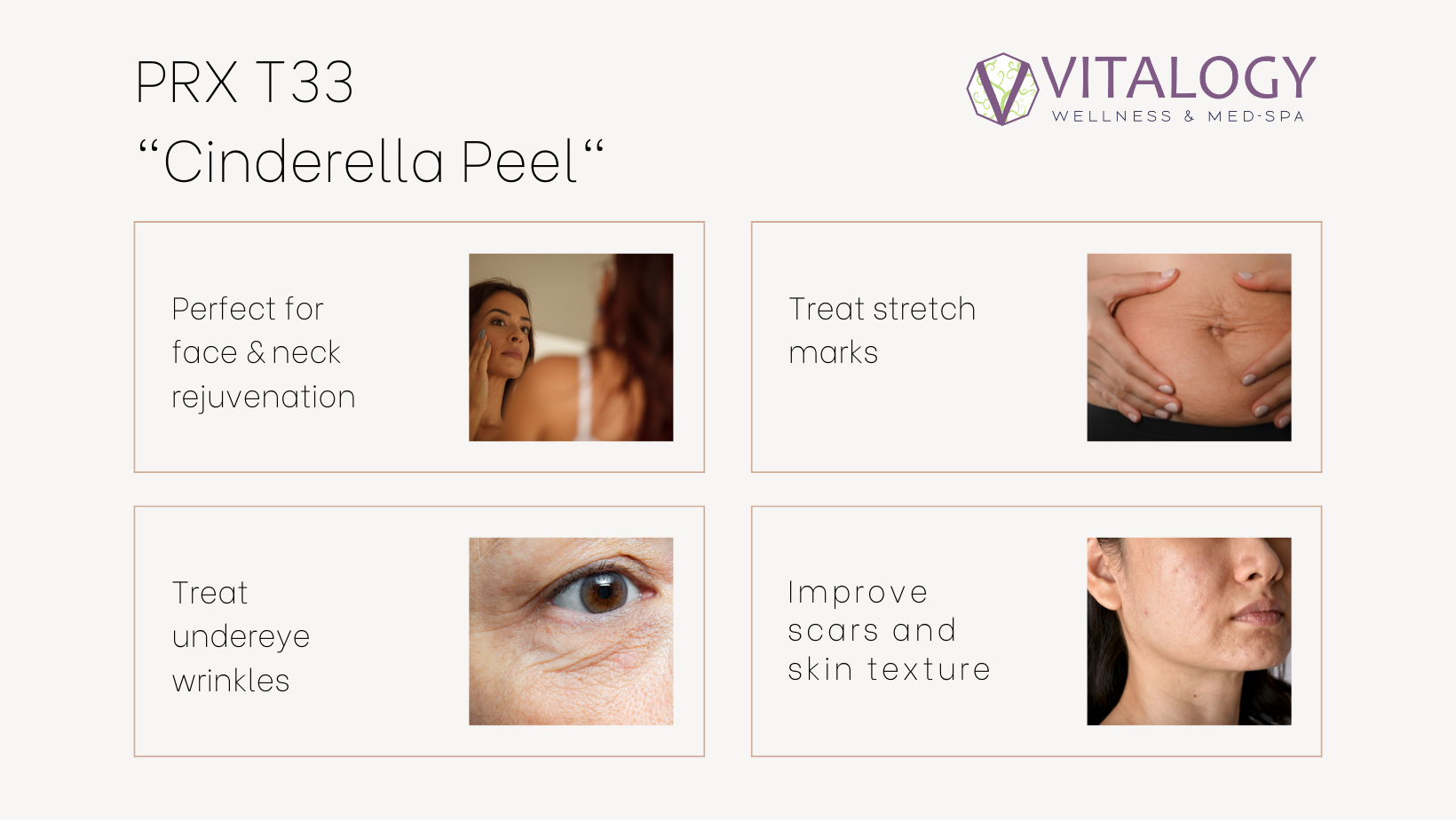 PRX T33 Skin Peel (Cinderella Peel) - Vitalogy Wellness Center